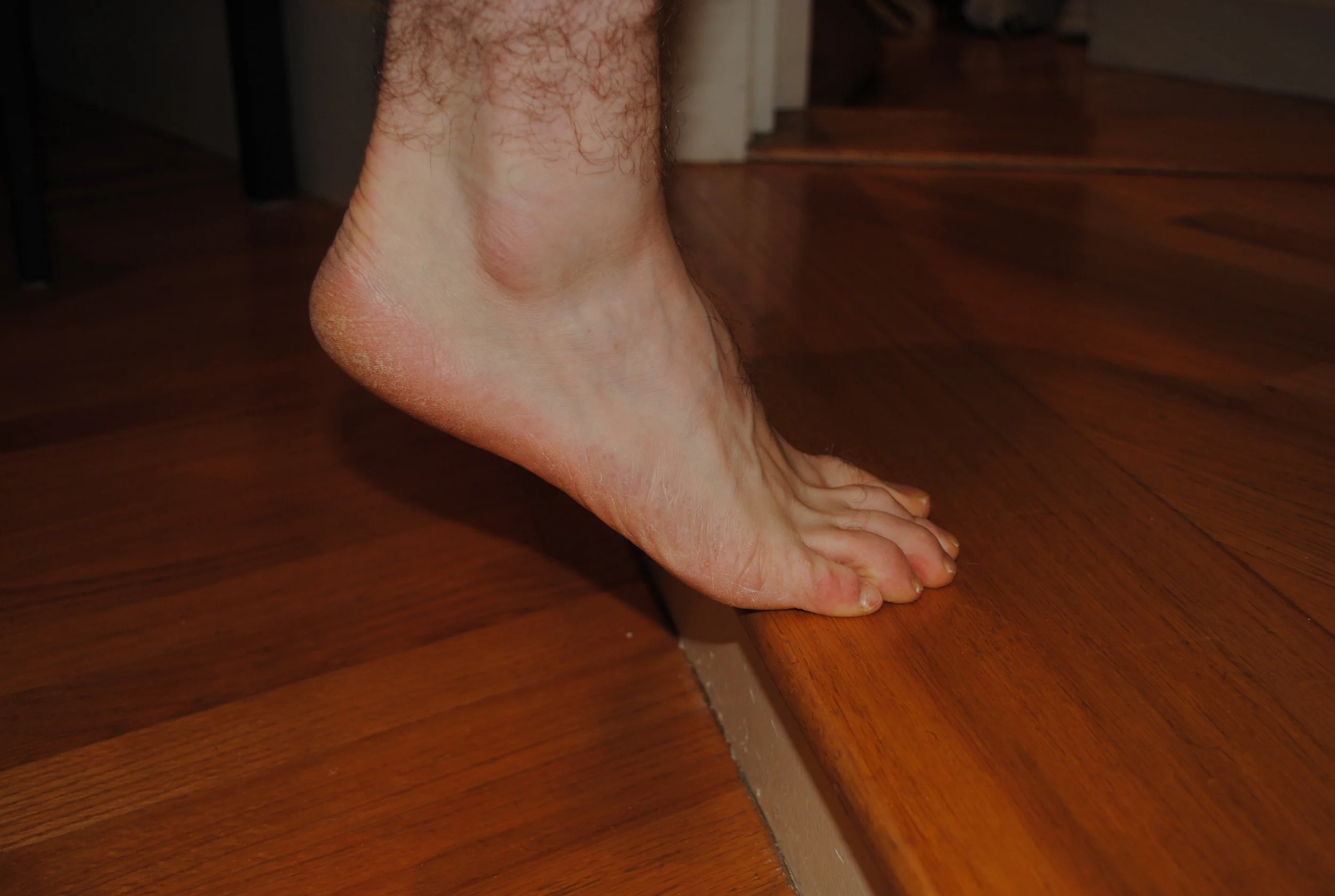 How to Run with Proper Form on a Prosthesis — Prosthetic Running