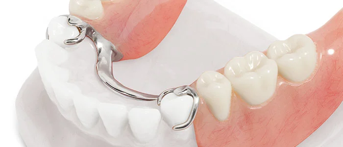 Denture and Partial — DK Dental Laboratory