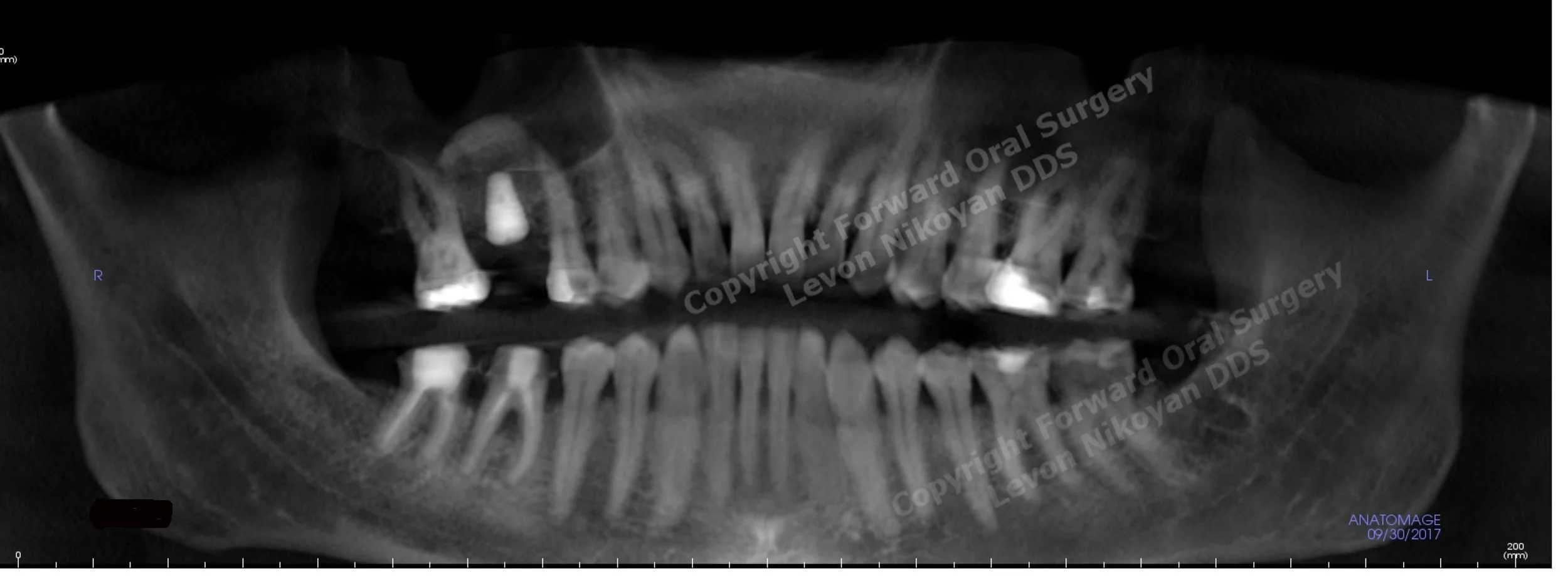 Forward Oral Surgery