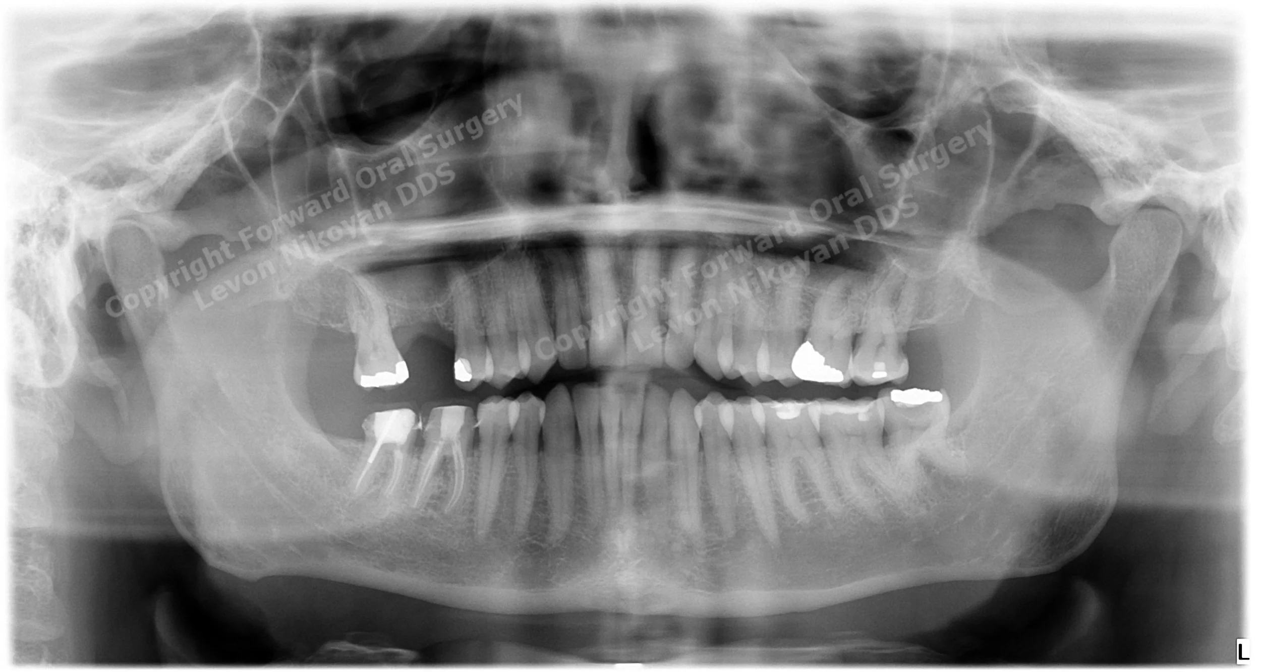 Forward Oral Surgery