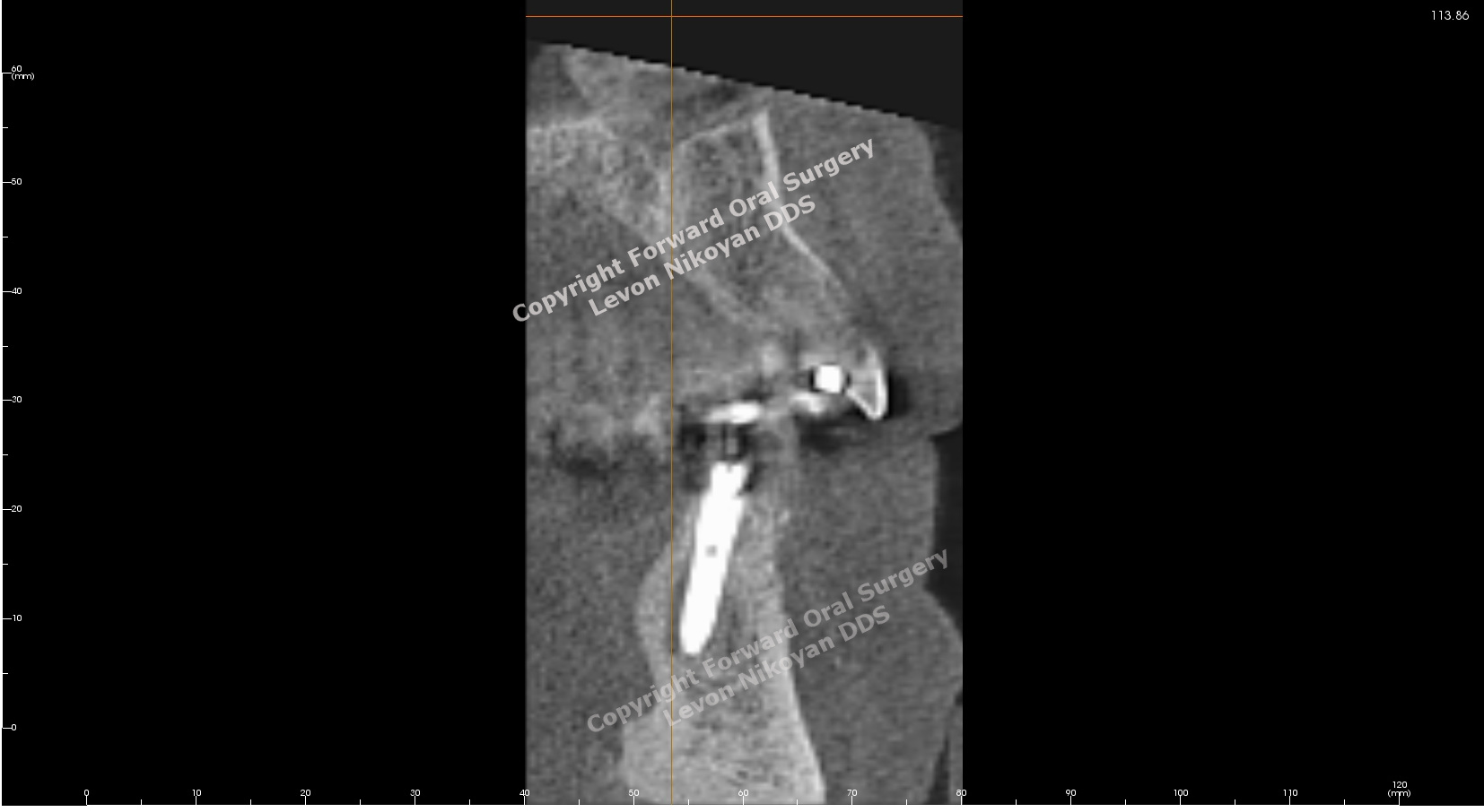 Forward Oral Surgery