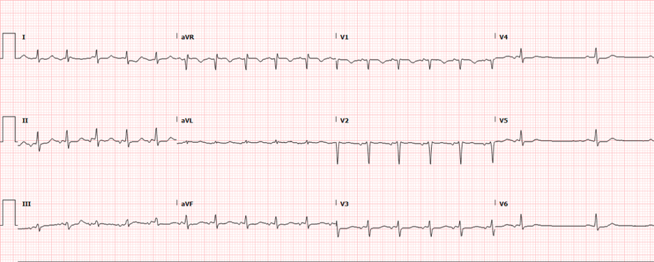 Abdomen/GI — Cook County EM Blog — Cook County Emergency Medicine Residency