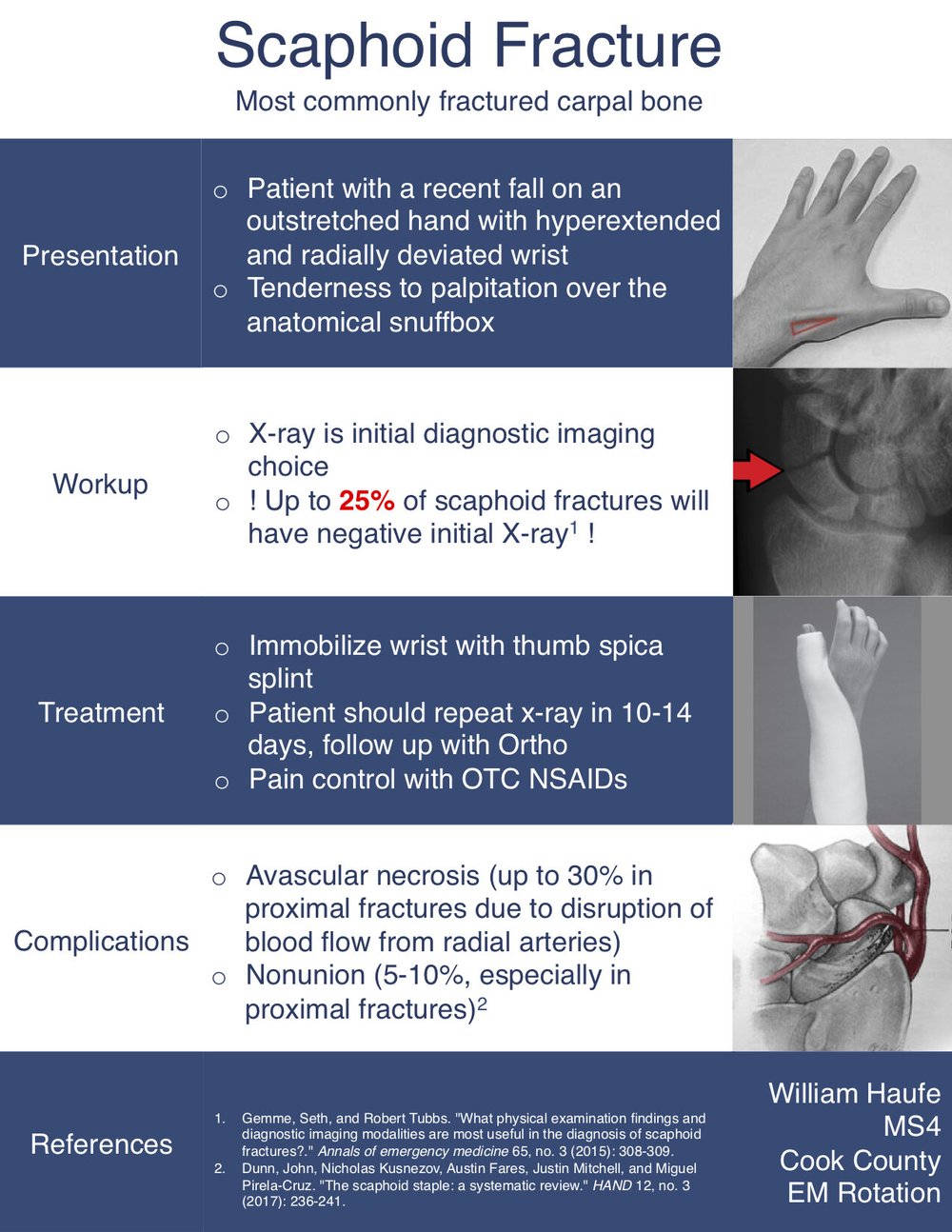 M4 Infographics: Scaphoid Fracture — Cook County Emergency Medicine ...