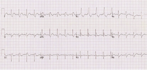 The Heart Of The Matter - A Case of Substernal Chest Pain — Cook County ...