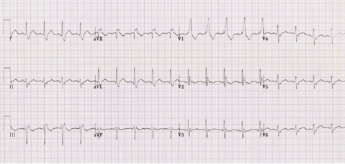 The Heart Of The Matter - A Case of Substernal Chest Pain — Cook County ...