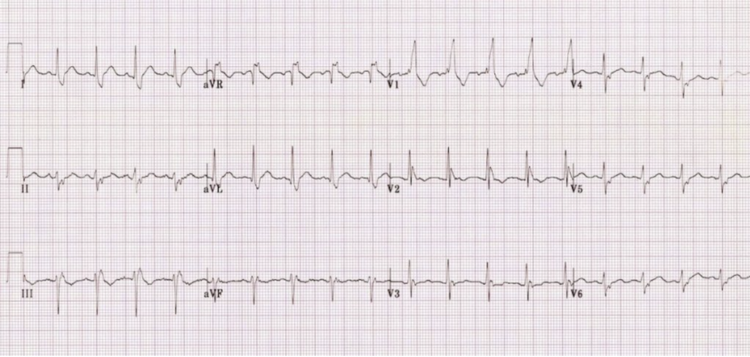 The Heart Of The Matter - A Case of Substernal Chest Pain — Cook County ...