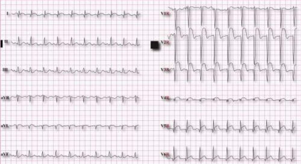 Heart of the Matter: Dextrocardia — Cook County Emergency Medicine ...