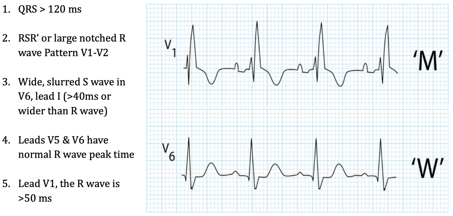 The Heart Of The Matter - A Case of Substernal Chest Pain — Cook County ...
