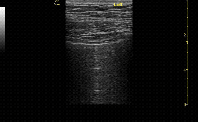 EFAST — Cook County Emergency Medicine Residency