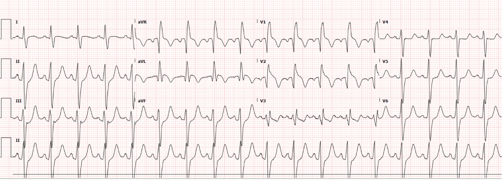 The Heart Of The Matter - A Case of Substernal Chest Pain — Cook County ...