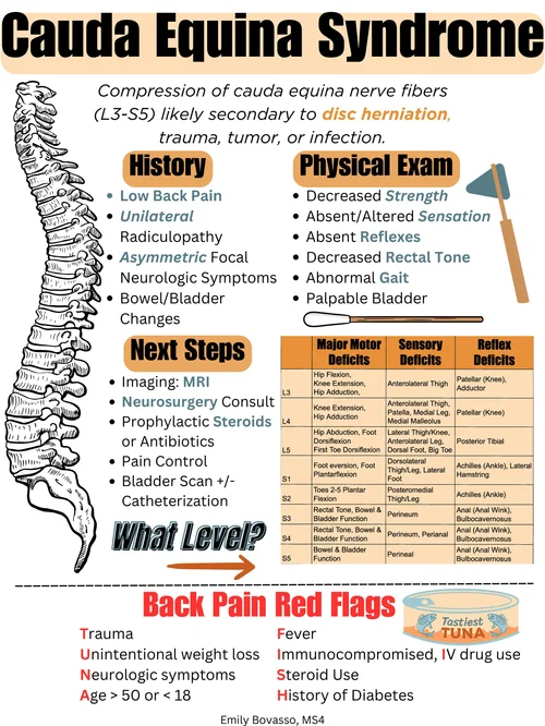Cauda Equina Syndrome Infographic — Cook County Emergency Medicine ...