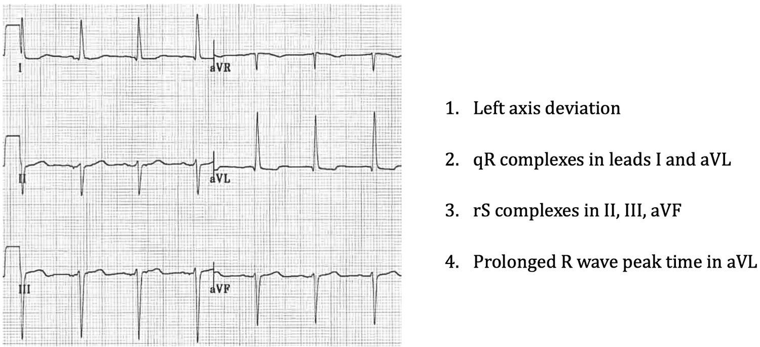 The Heart Of The Matter - A Case of Substernal Chest Pain — Cook County ...