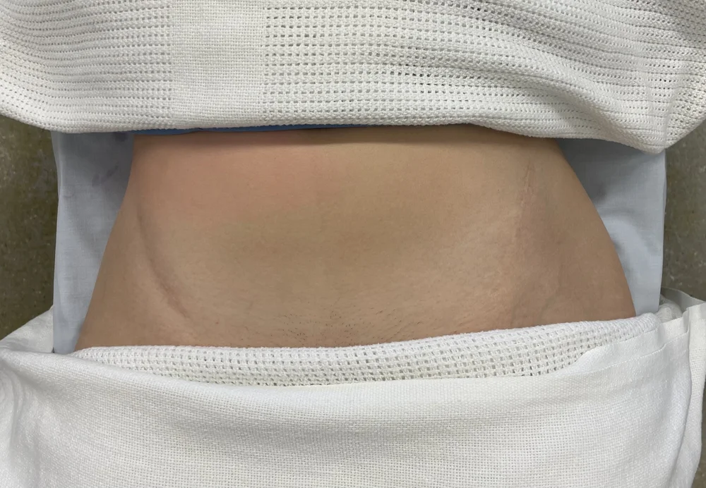 Matthew Boyle - Orthopaedic Surgeon - Periacetabular Osteotomy | PAO ...
