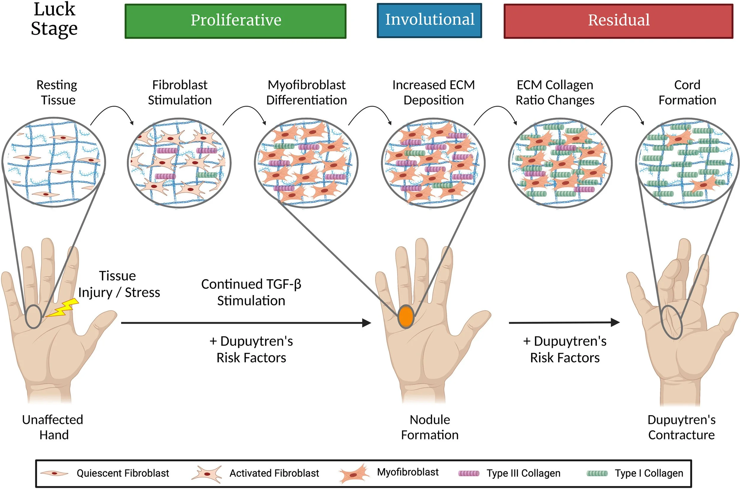 Massage Therapy for People with Dupuytren's Disease — Richard Lebert ...