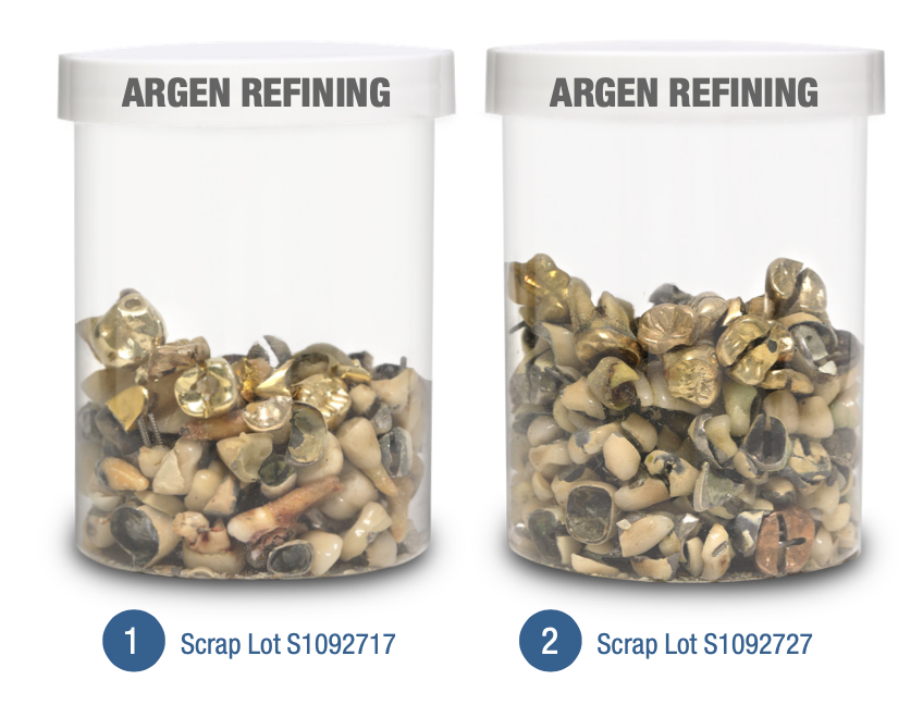 Your Dental Scrap is Worth More Than Ever! — Atlanta Dental