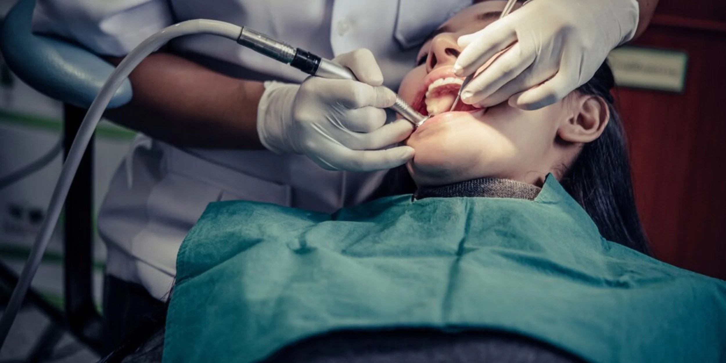 Tips to Care for Your Dental Filling for Lasting Results.