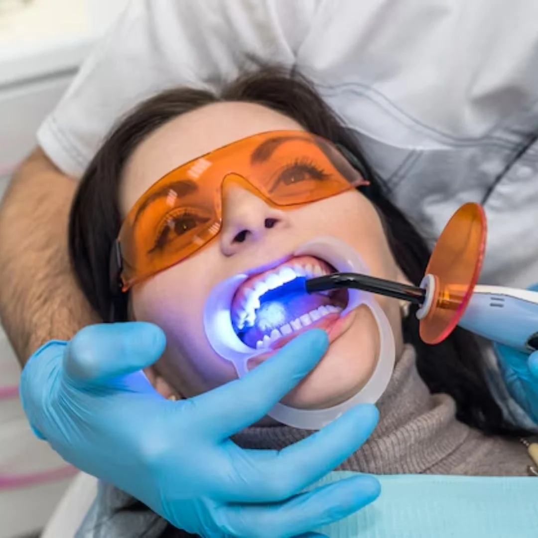 Manage Tooth Sensitivity After Whitening Treatments: Guide