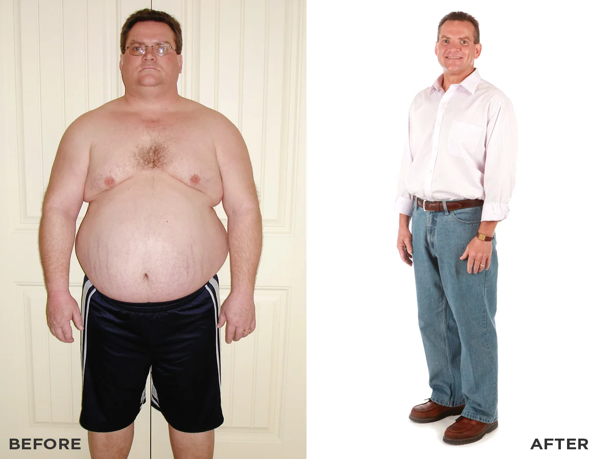 Extreme Weight Loss Before And After Male