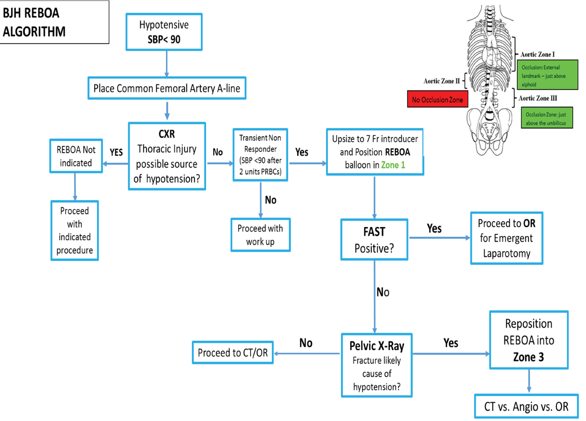 REBOA: Resuscitative Endovascular Balloon Occlusion of the Aorta ...