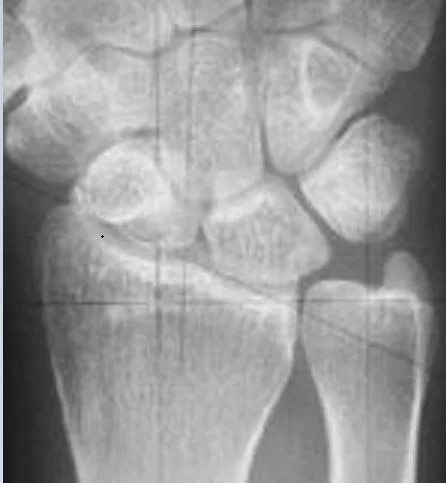 A 40 y.o. male complains of wrist pain after a fall. — Everyday E(B)M