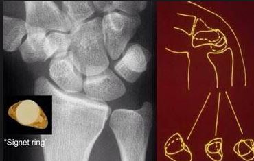 A 40 y.o. male complains of wrist pain after a fall. — Everyday E(B)M