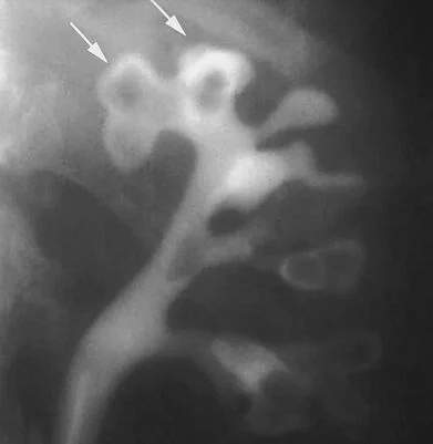 A 40 y.o. male complains of wrist pain after a fall. — Everyday E(B)M