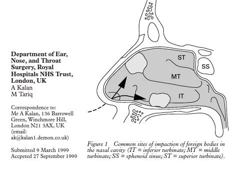 A 45 y.o. female was picking her nose with a bobby pin when it "opened ...