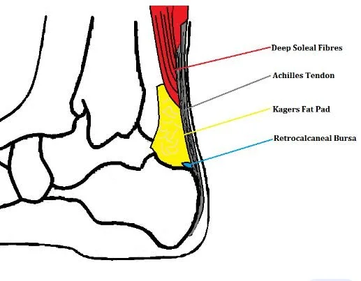 A 66 y.o. woman was hit in the back of the leg by a heavy hedge trimmer ...