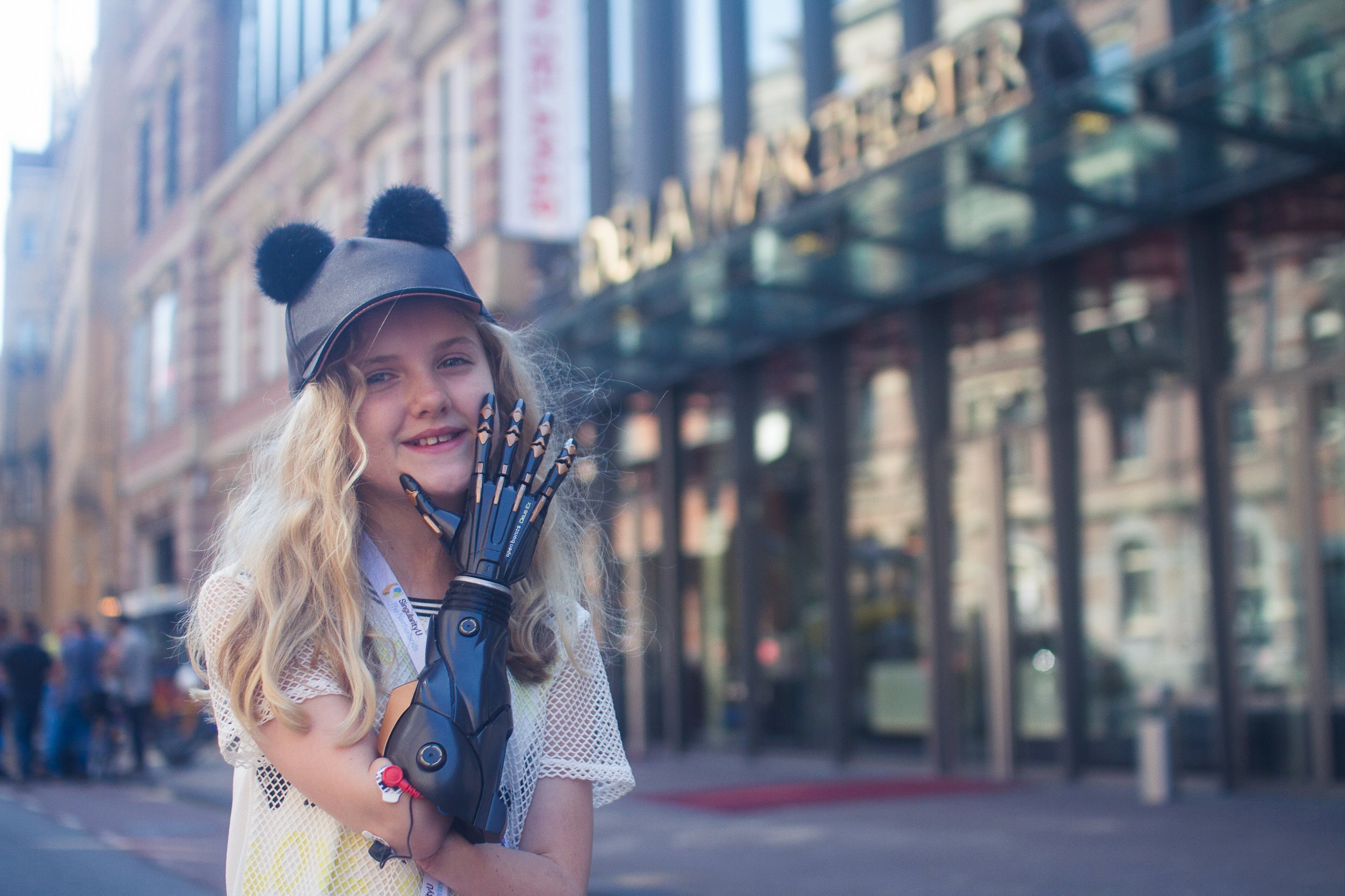 NHS & Open Bionics one step closer to providing world-first 3D printed ...