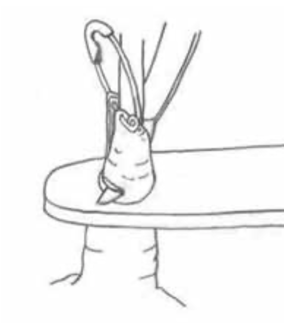 AccuCirc Device — SafeCirc Clinic