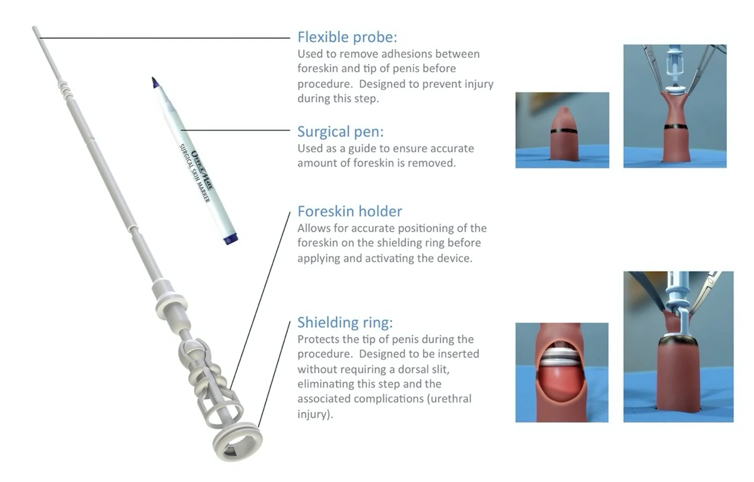 AccuCirc Device — SafeCirc Clinic