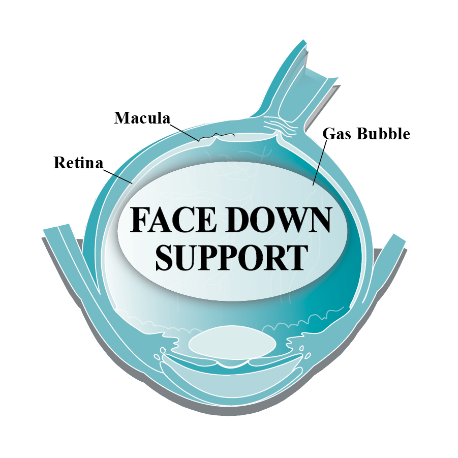 Protect Your Vision...Enhance Surgical Success! - Face down equipment