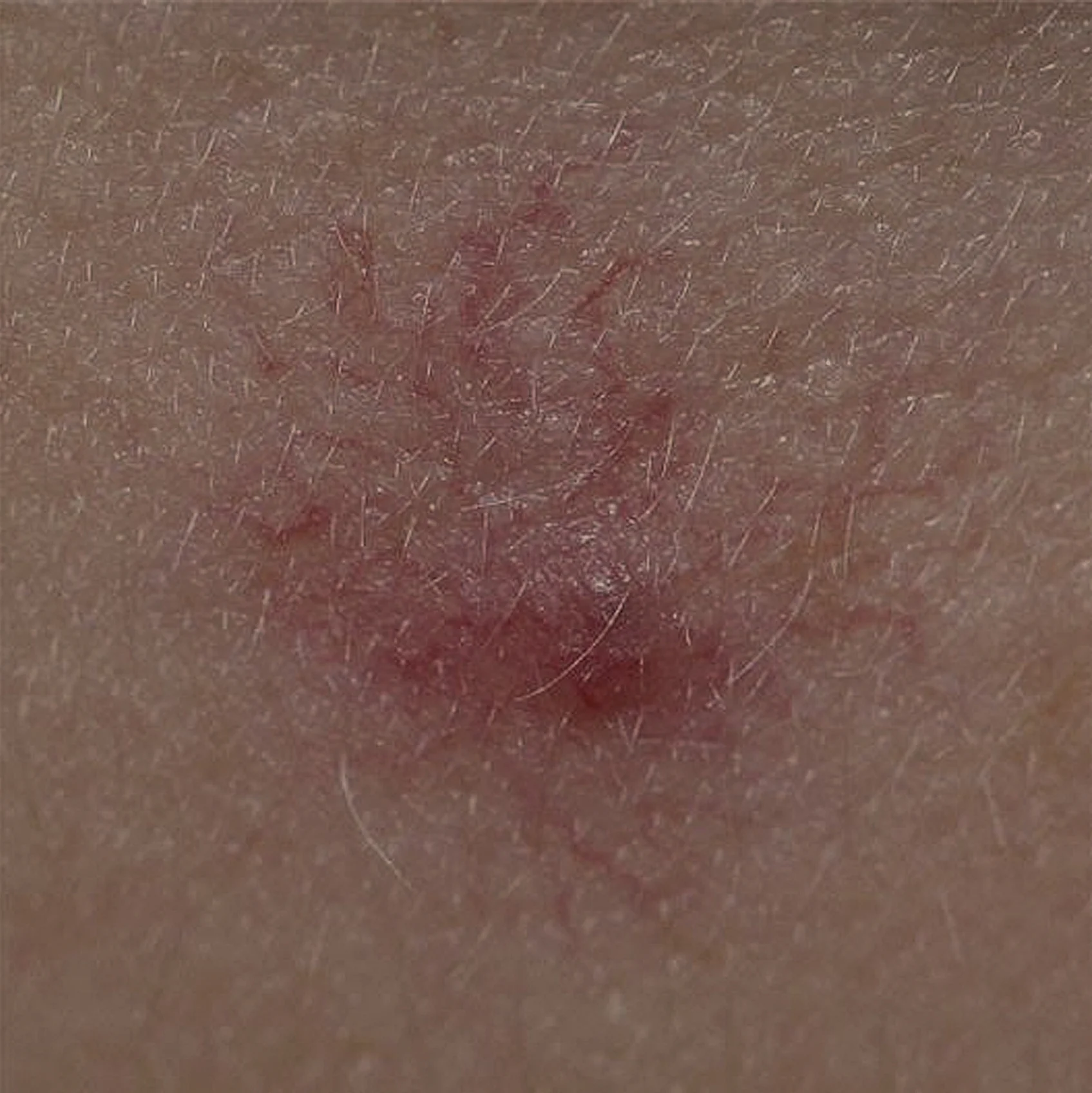 Maryse Dusseault Esthétiquemaryse dussault estheticienne