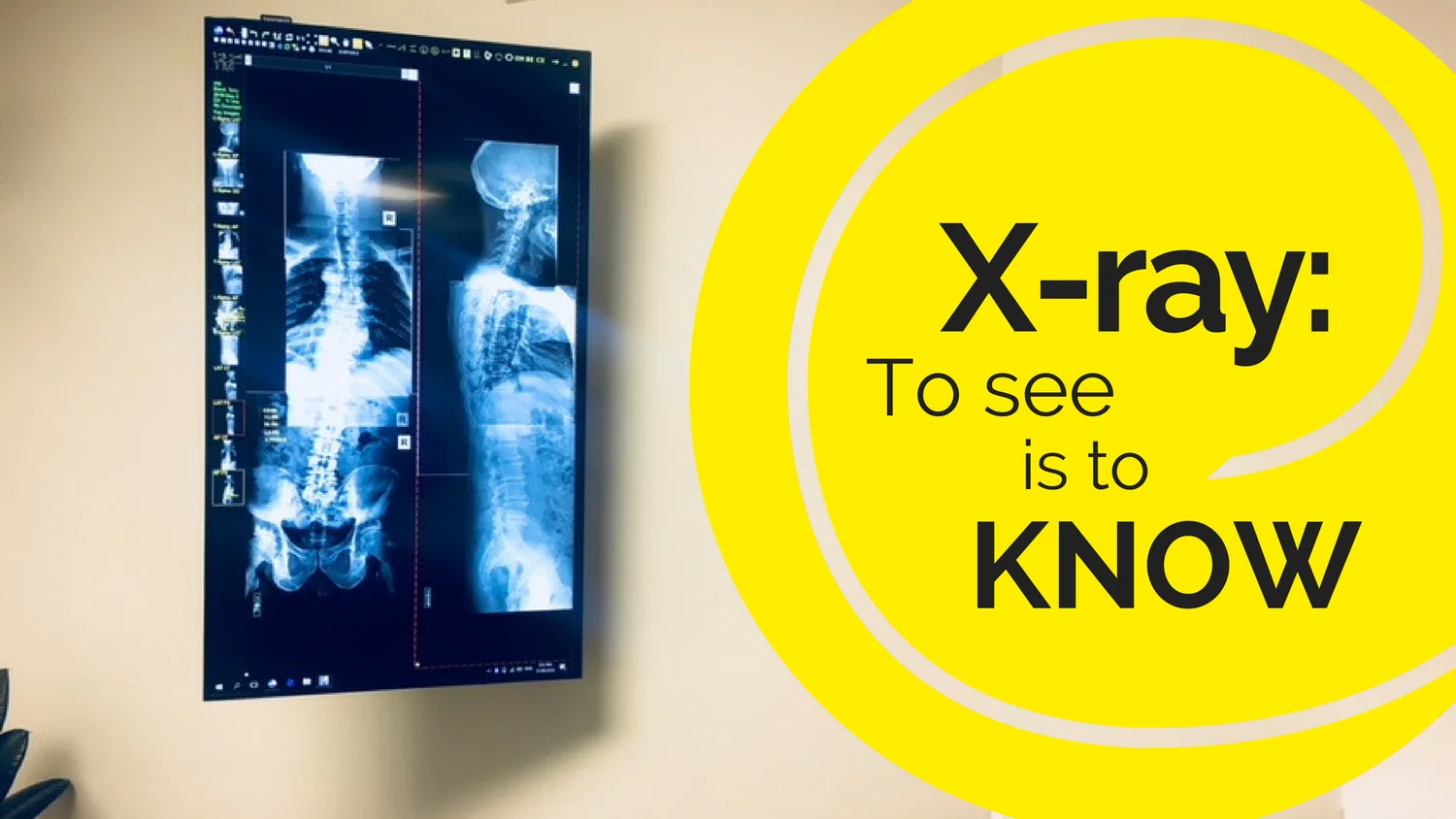 To see is to know: The Purpose and Importance of Spinal X-rays ...