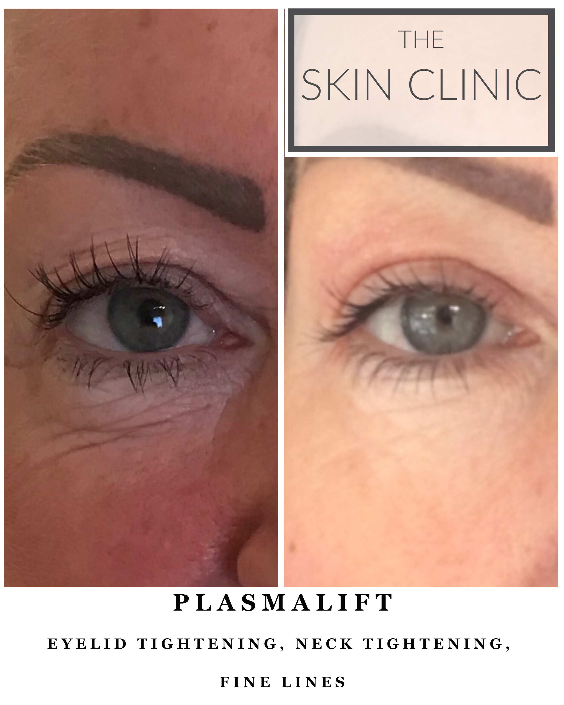 Client Treatment Gallery — The Skin Clinic