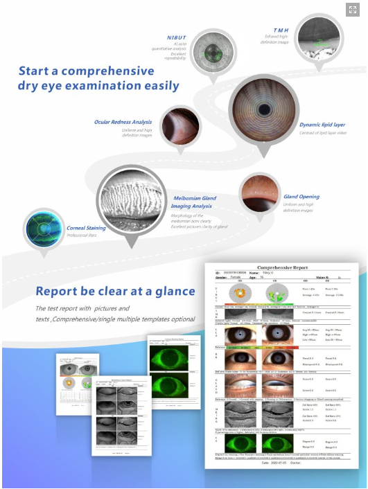 Dry eye diagnosis using Meibomography, NITBUT, Tear Lipid analysis ...