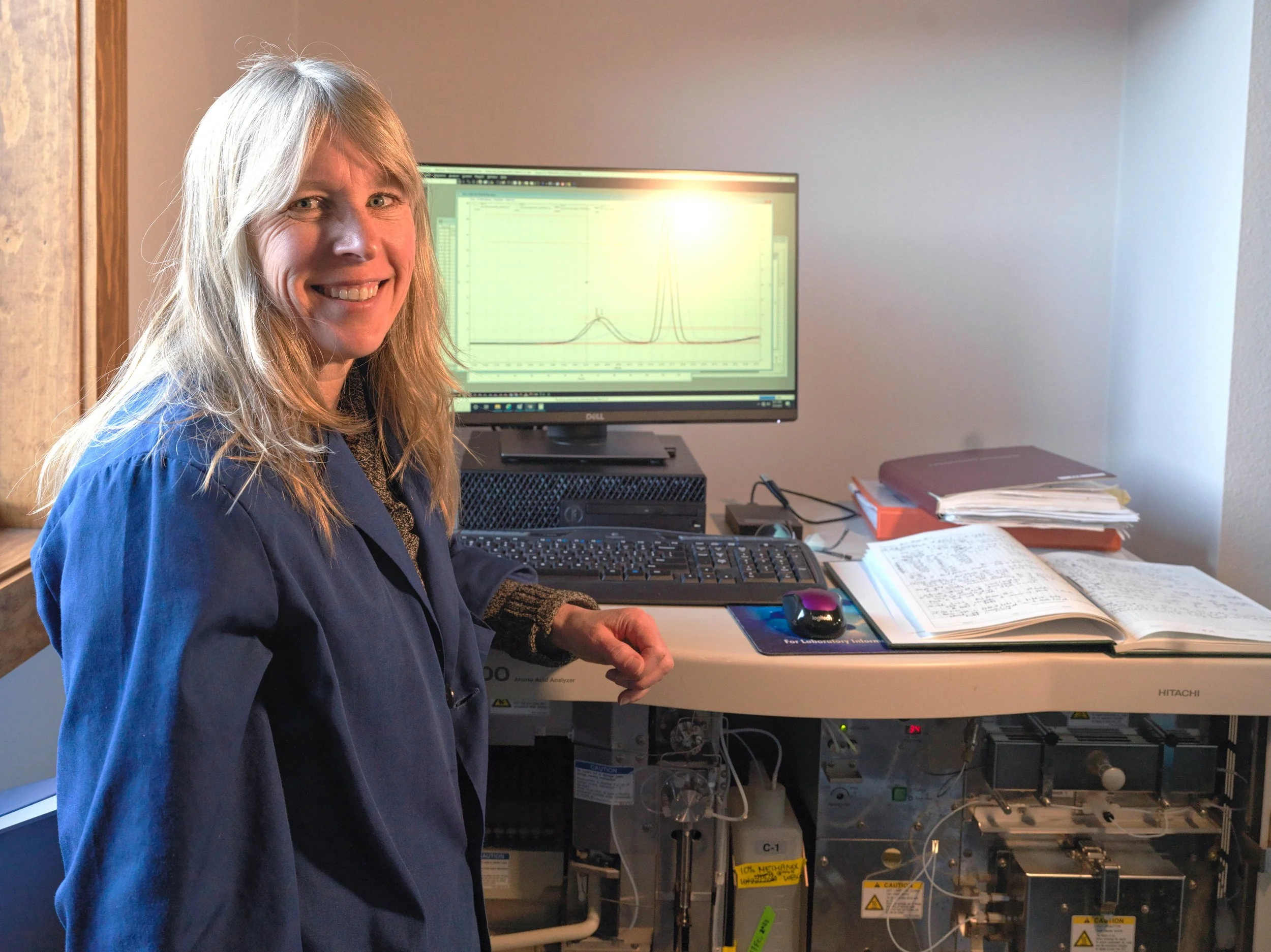 New Alzheimer’s Biomarker May Facilitate Rapid Diagnosis — Brain ...