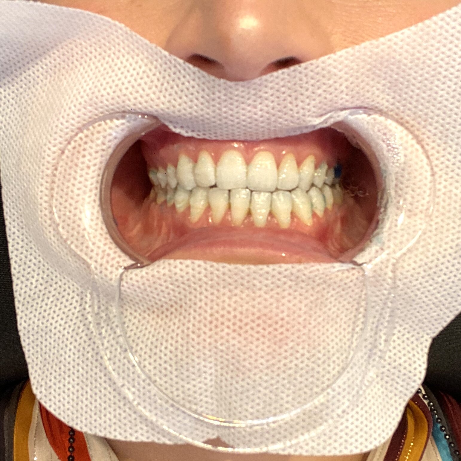 The Whitening Co - BeautyEQ