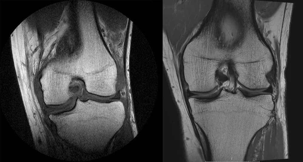 Imaging — Andreas H. Gomoll, MD