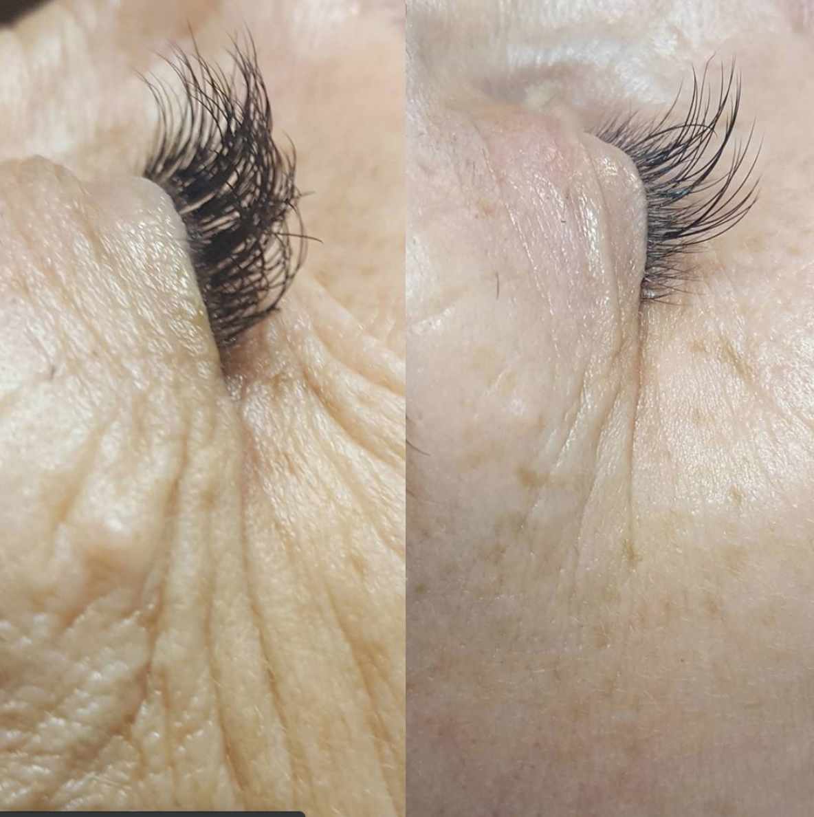 Dermaesthetics Beverly Hills — SkinBio365