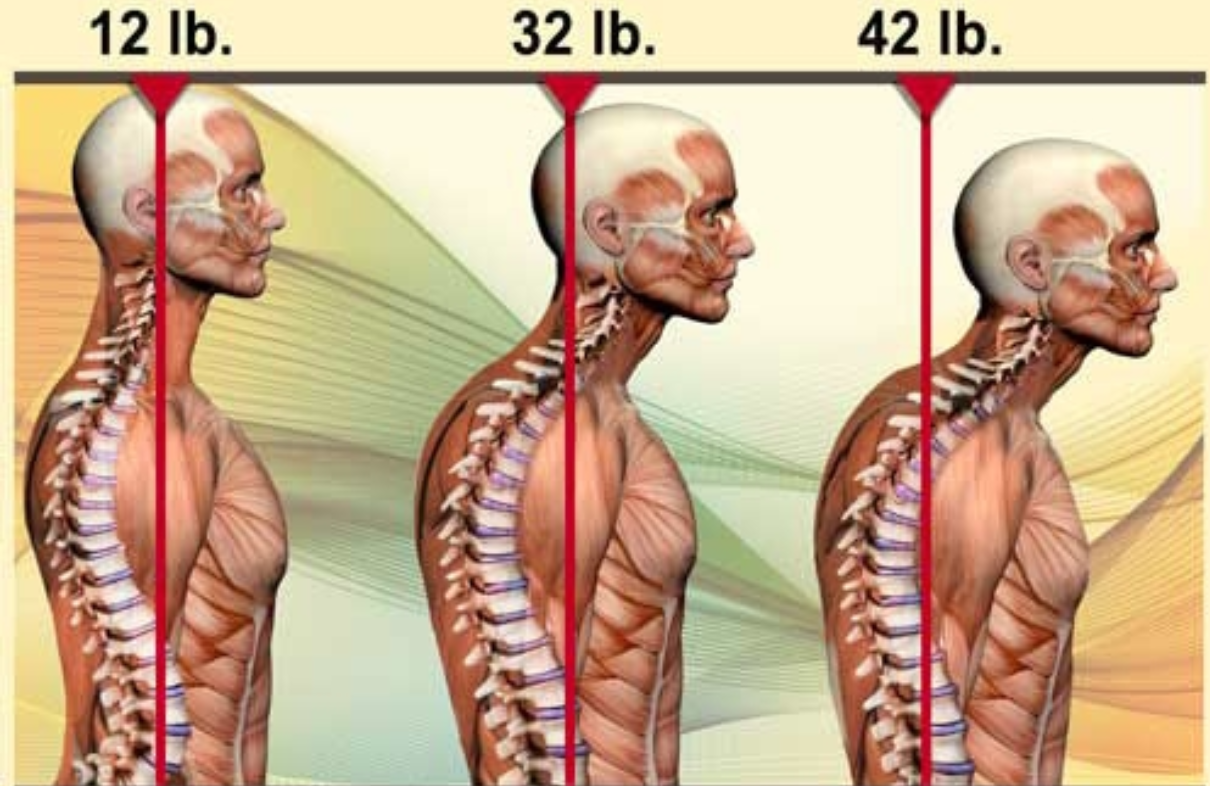 Master Class: Kyphosis and Forward Head — Ellie Herman Pilates
