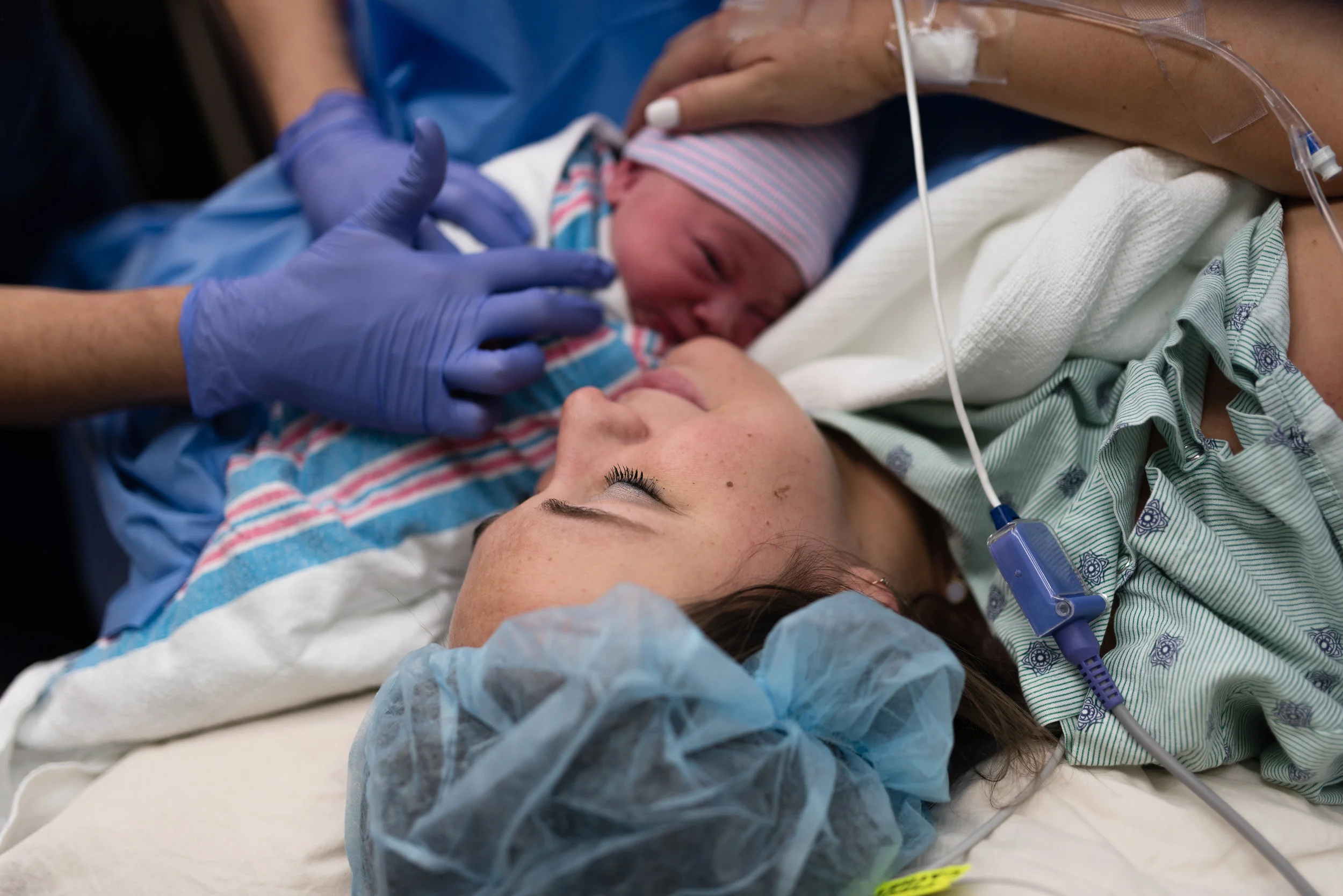 C Section Birth Photography