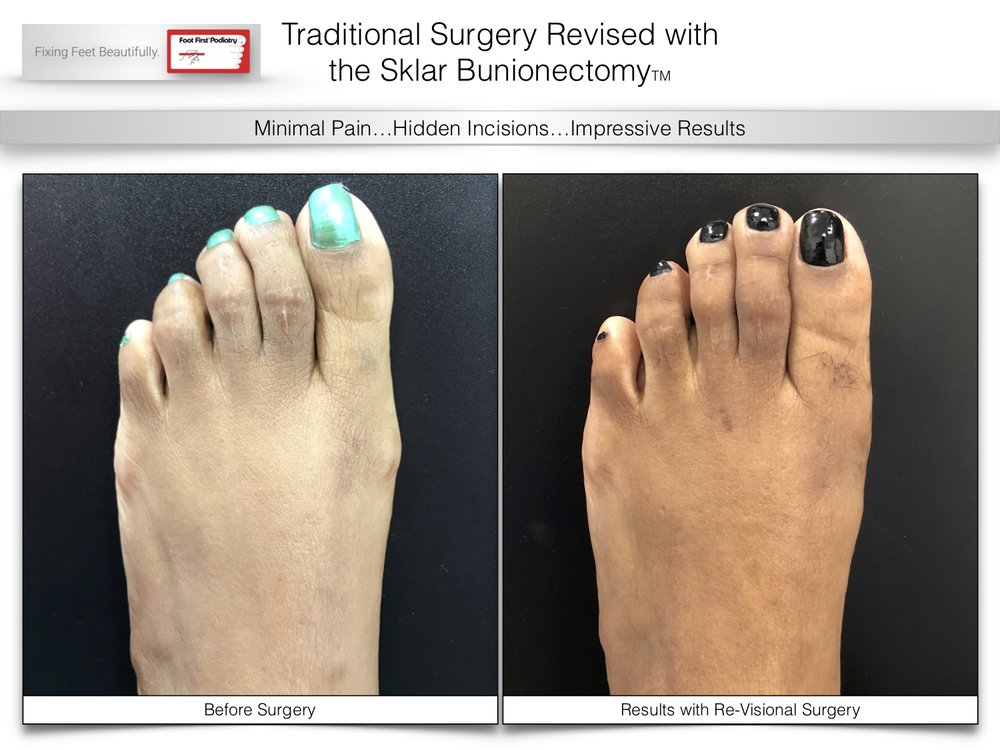 Long, short, curled or even just plain ugly toes? At Foot First we can ...