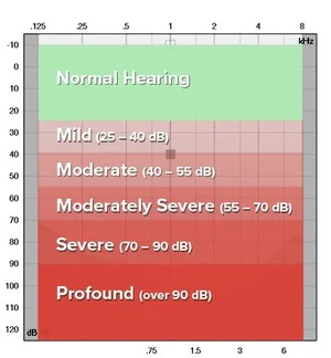 Understanding Audiograms: A Comprehensive Guide to Your Hearing Health ...