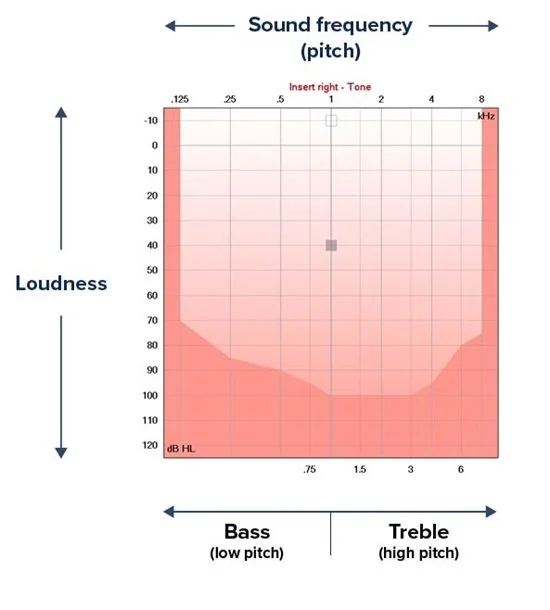 Understanding Audiograms: A Comprehensive Guide to Your Hearing Health ...