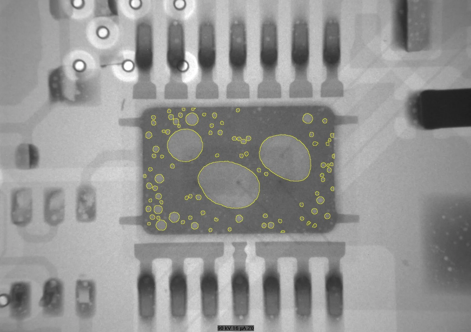 X-Ray Services — Elmet