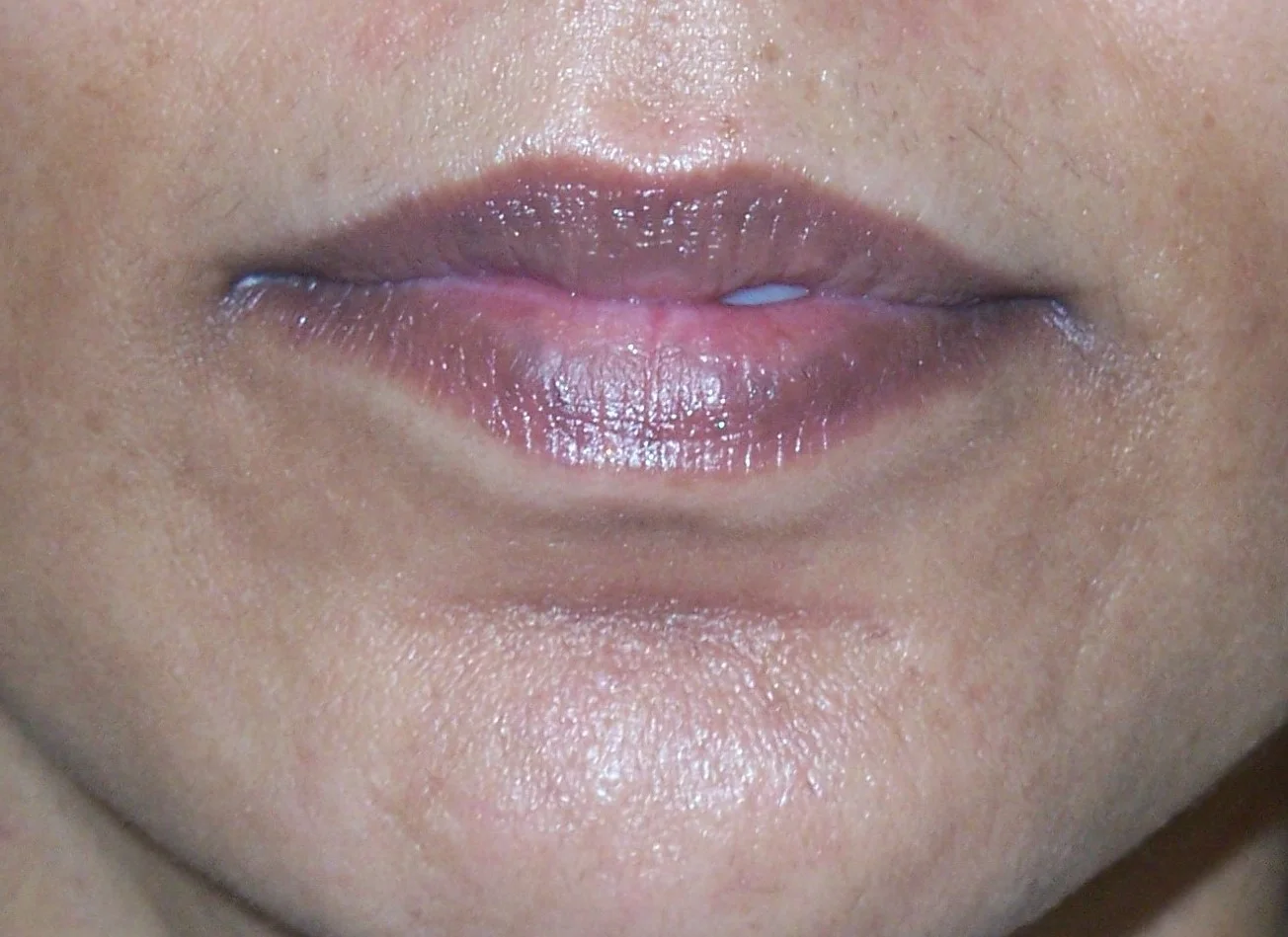 Toronto Medical Aesthetics