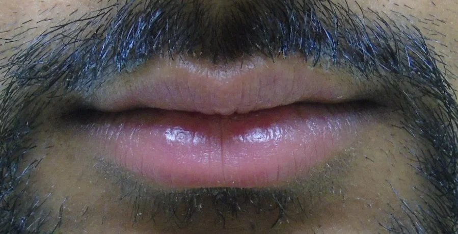 Toronto Medical Aesthetics