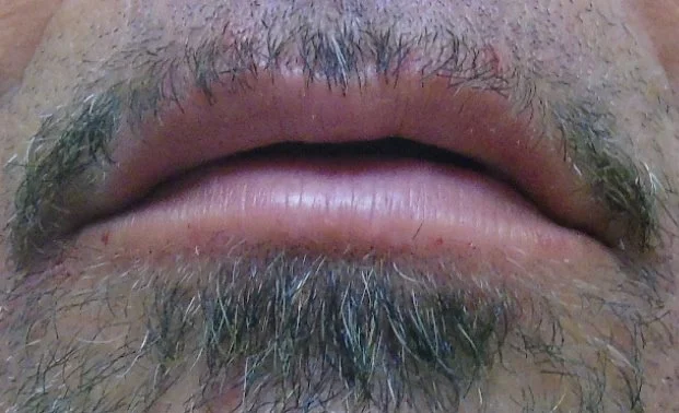 Toronto Medical Aesthetics