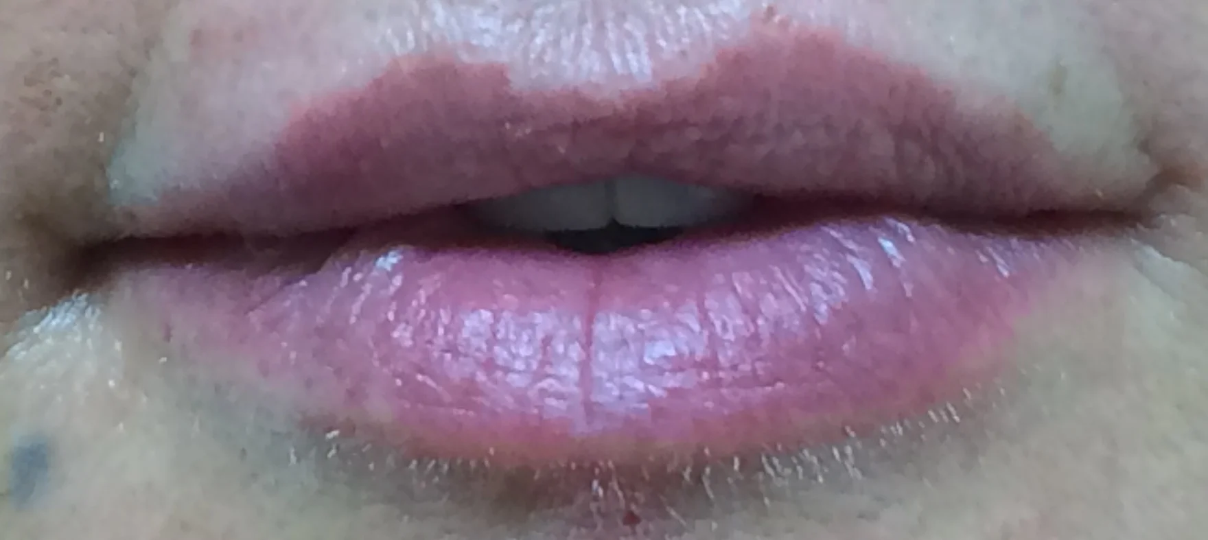 Toronto Medical Aesthetics